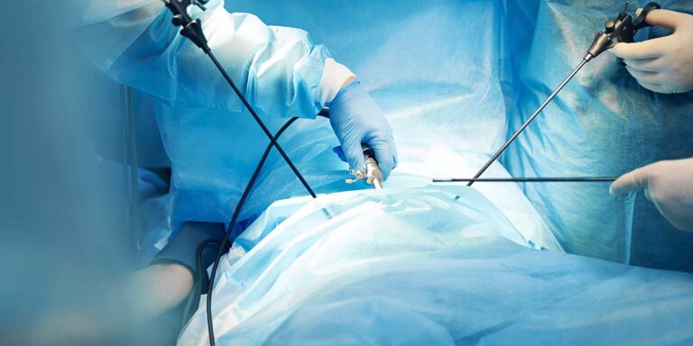 Cirurgia de vesícula: saiba tudo sobre a colecistectomia.